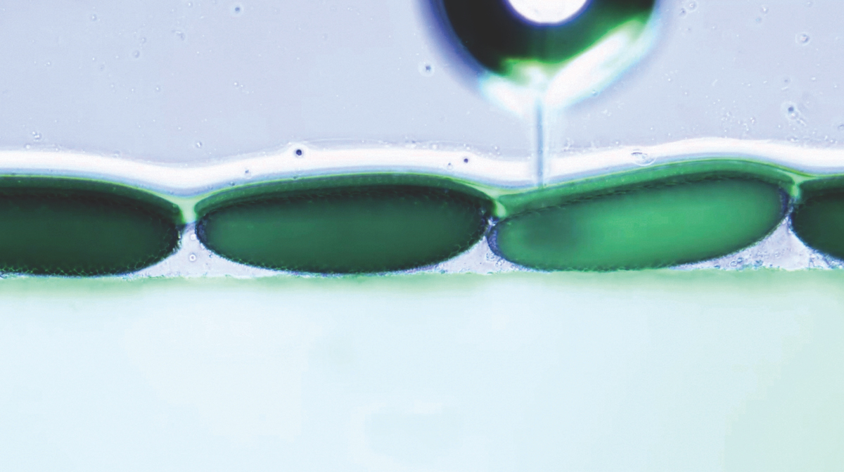 Wolbachia bacteria is reducing the impact of dengue, find out how ...